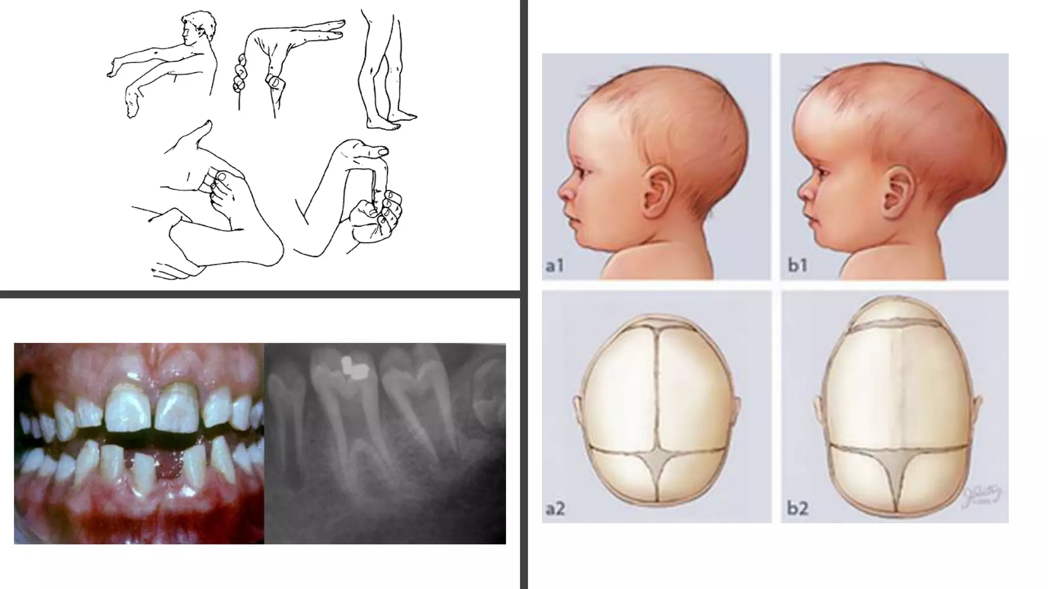 Tooth abnormality in systemic disease (Doctor Faris Alabeedi MSc ...