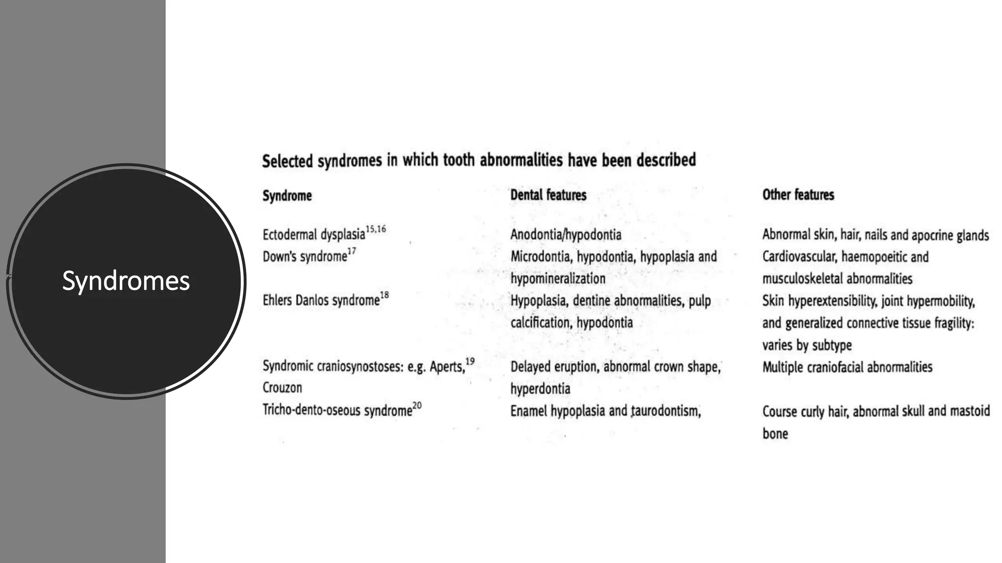 Tooth abnormality in systemic disease (Doctor Faris Alabeedi MSc ...
