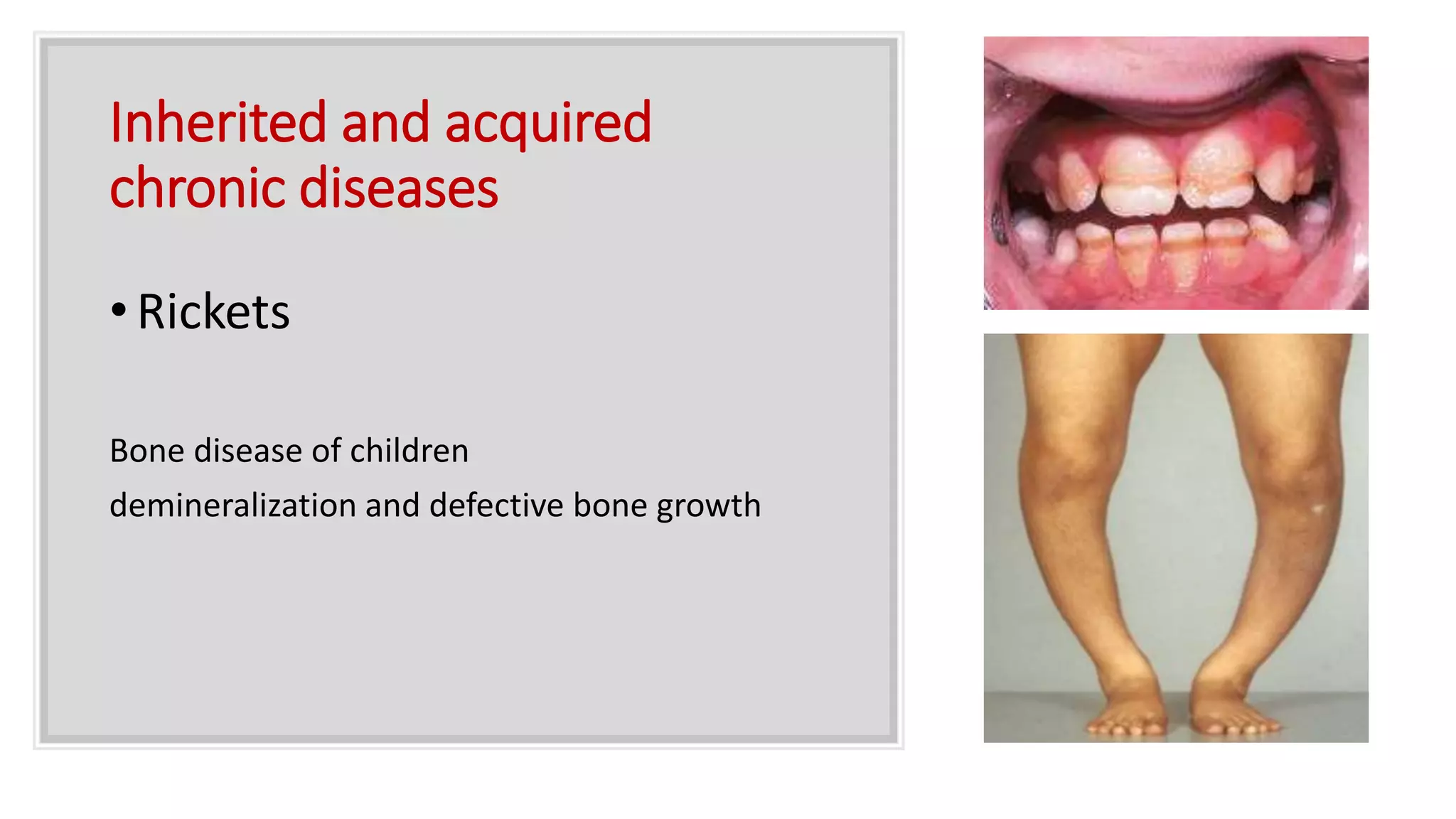 Tooth abnormality in systemic disease (Doctor Faris Alabeedi MSc ...