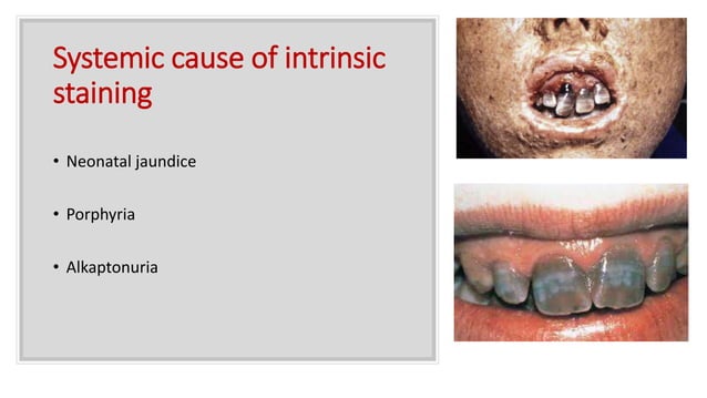 Tooth abnormality in systemic disease (Doctor Faris Alabeedi MSc ...