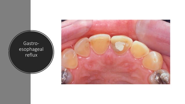 Tooth abnormality in systemic disease (Doctor Faris Alabeedi MSc ...