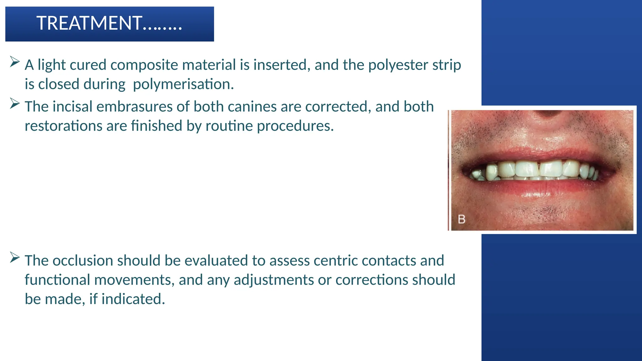 tooth alterations for smile design presentation.pptx