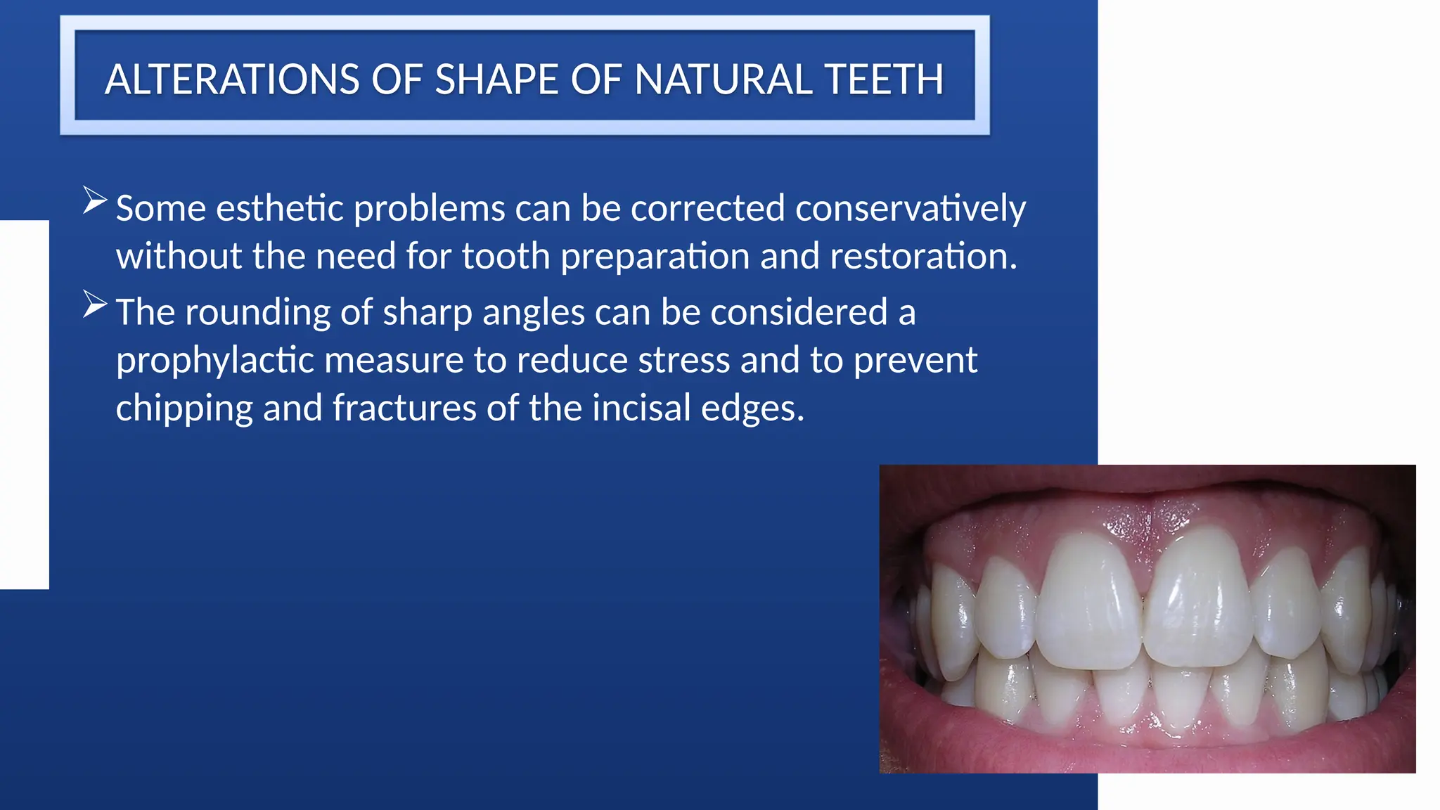 tooth alterations for smile design presentation.pptx
