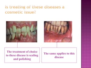 Tooth an important but neglected part of the | PPT