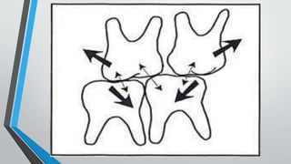 Tooth attrition | PPTX