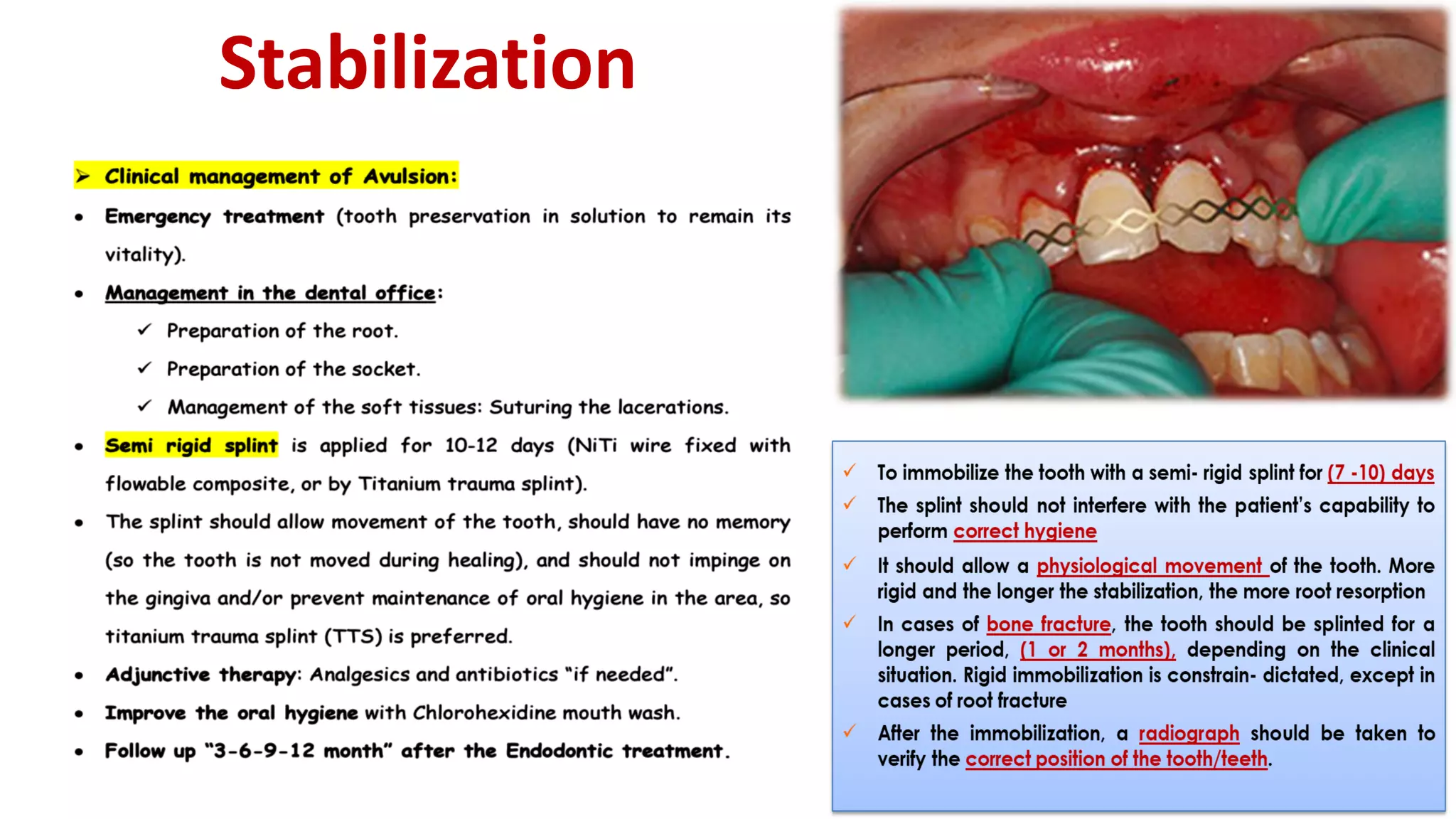 tooth avulsion.pdf