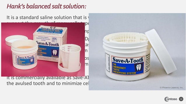 Tooth avulsion dr.maryam salman | PPT