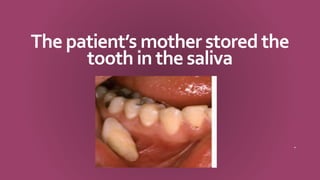 Tooth avulsion dr.maryam salman | PPTX