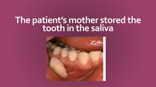 Tooth avulsion dr.maryam salman | PPT