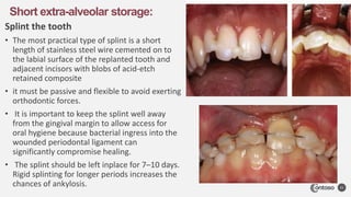 Tooth avulsion dr.maryam salman | PPTX | Injuries | Diseases and Conditions