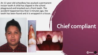Tooth avulsion dr.maryam salman | PPTX | Injuries | Diseases and Conditions