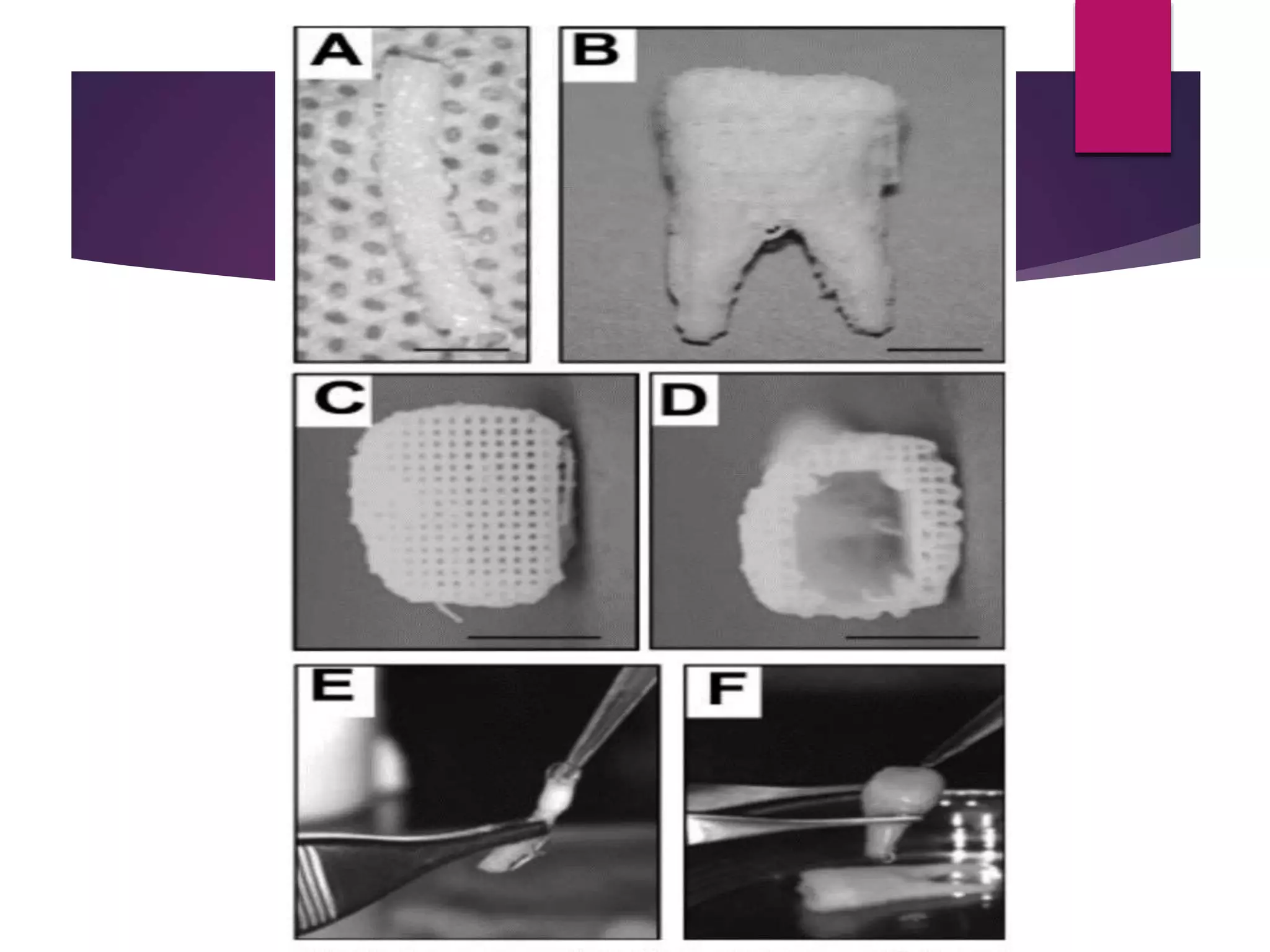 Tooth bioengineering and the next generation of dentistry | PPTX