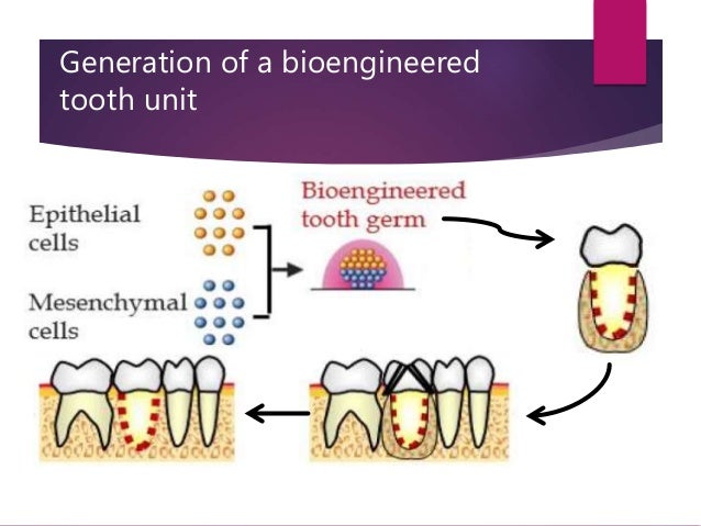 Tooth bioengineering and the next generation of dentistry