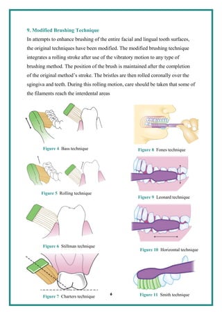 Toothbrushes and toothbrushes methods | PDF