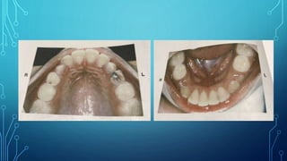 Toothbrushing Assignment for Maya | PPT