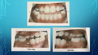 Toothbrushing Assignment for Maya | PPT | Free Download