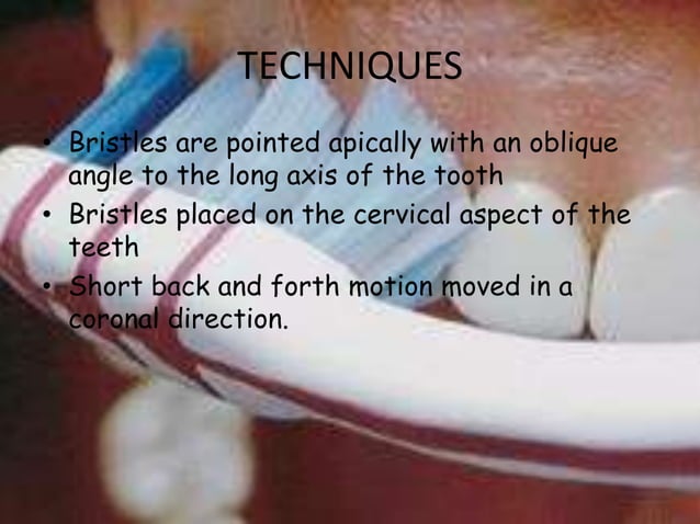 Tooth brushing techniques | PPTX | Dental Health | Diseases and Conditions