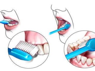 Tooth Brushing Technique By Mikkel Juul Jensen Science