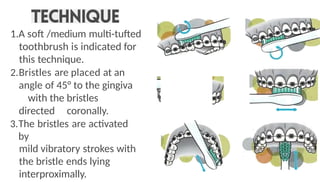 TOOTH BRUSHING TECHNIQUES useful for perio and phd as well | PPTX