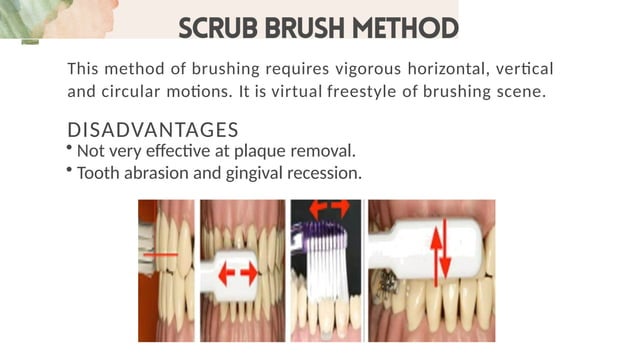 TOOTH BRUSHING TECHNIQUES useful for perio and phd as well | PPT