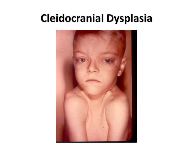 Tooth calcification and eruption.pptx | Oral care | Personal Care