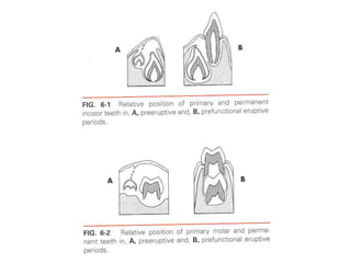 Tooth calcification and eruption.pptx