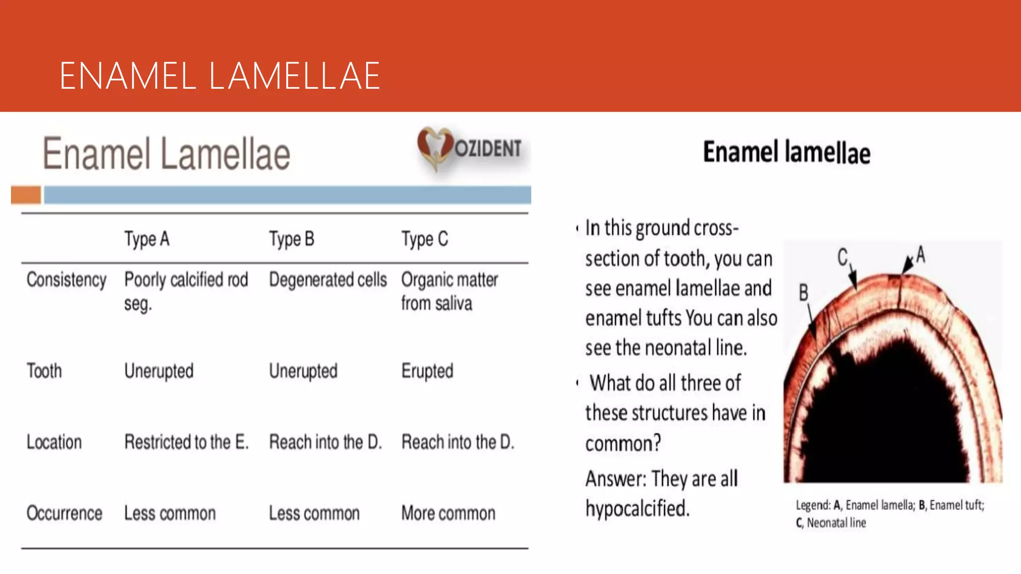 Tooth components. Enamel | PPTX