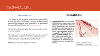Tooth components. Enamel | PPTX