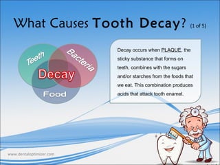 Tooth decayfinal | PPT