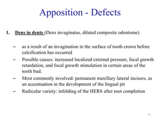 Development of Teeth | PPTX