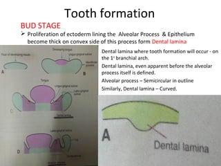Tooth development for the embryology.. | PPT