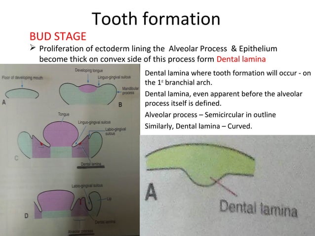 Tooth development for the embryology.. | PPT