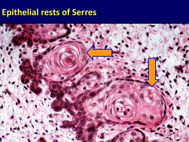 Tooth development .. hesham dameer