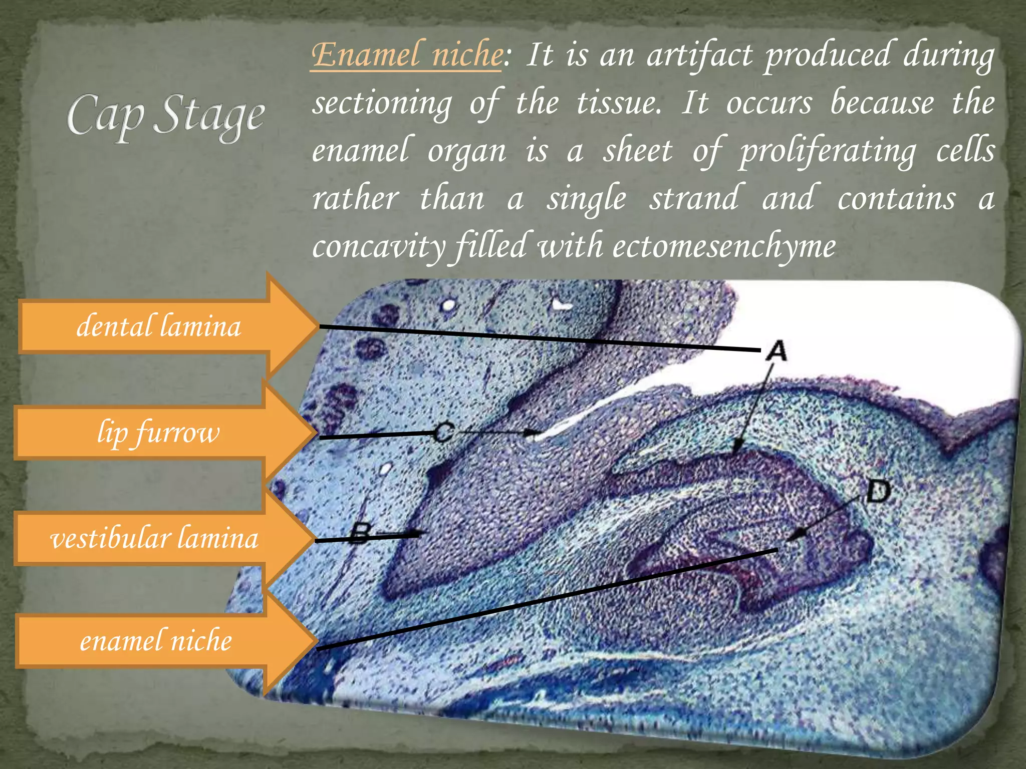 Tooth development | PPTX