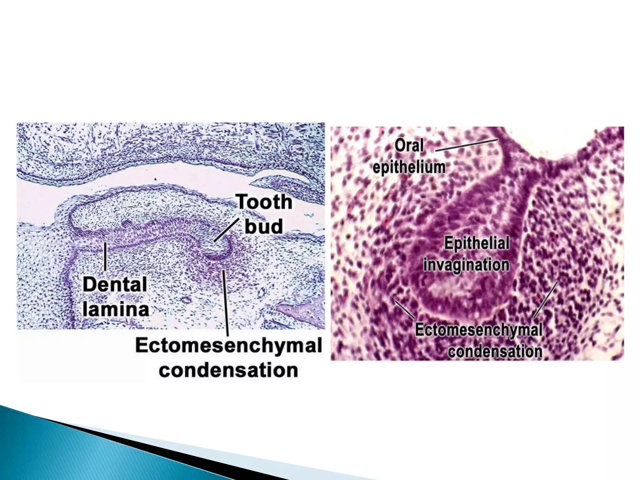Tooth development | PPTX