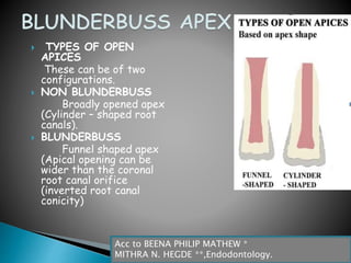 Tooth development | PPTX