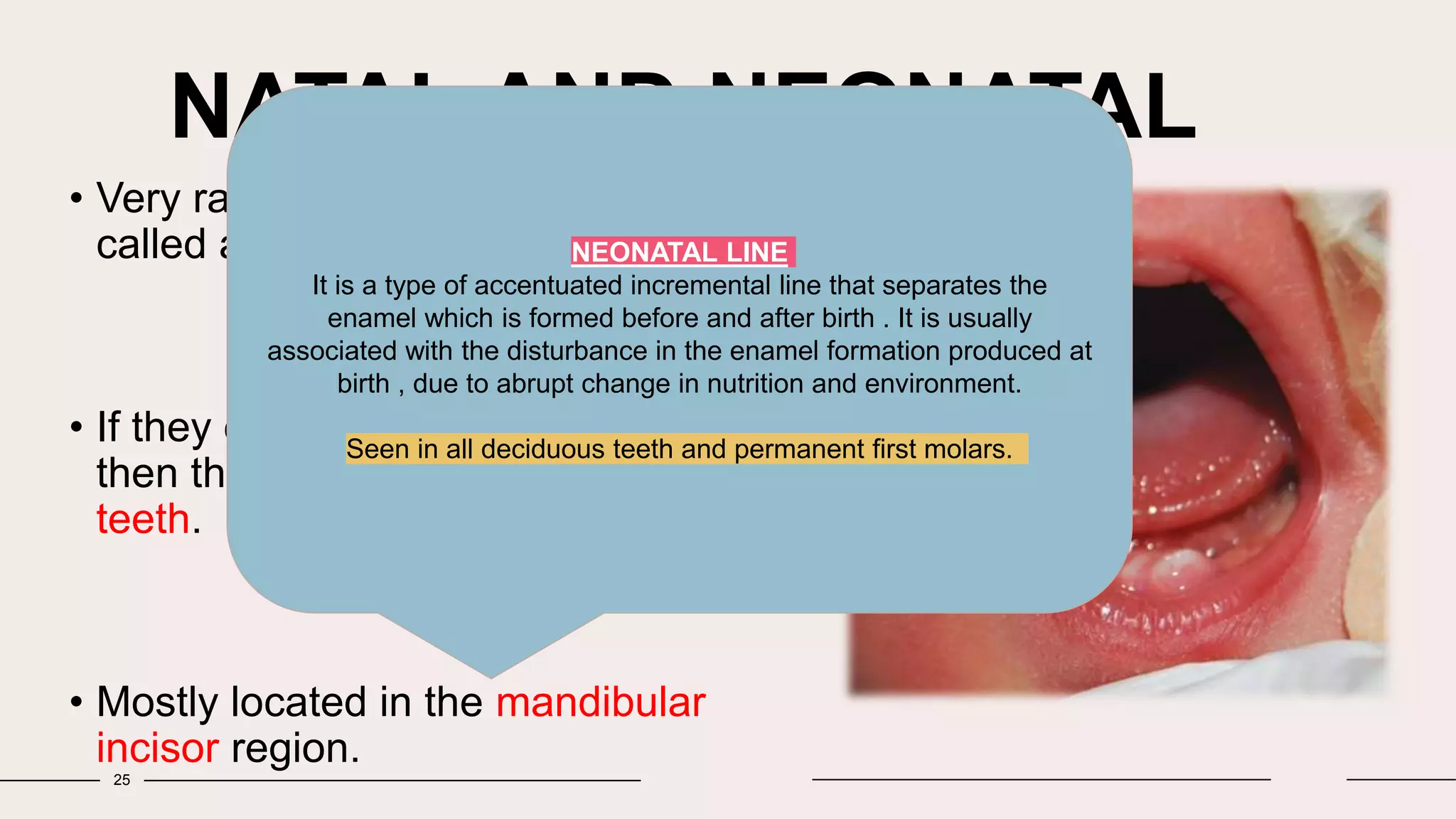 tooth development.pptx