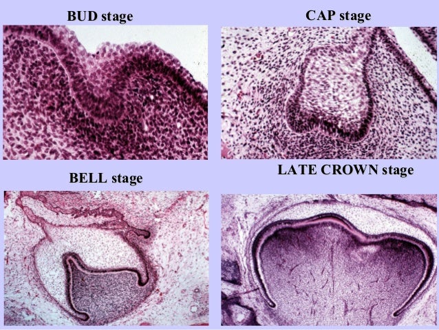 Tooth development med.gen.engl