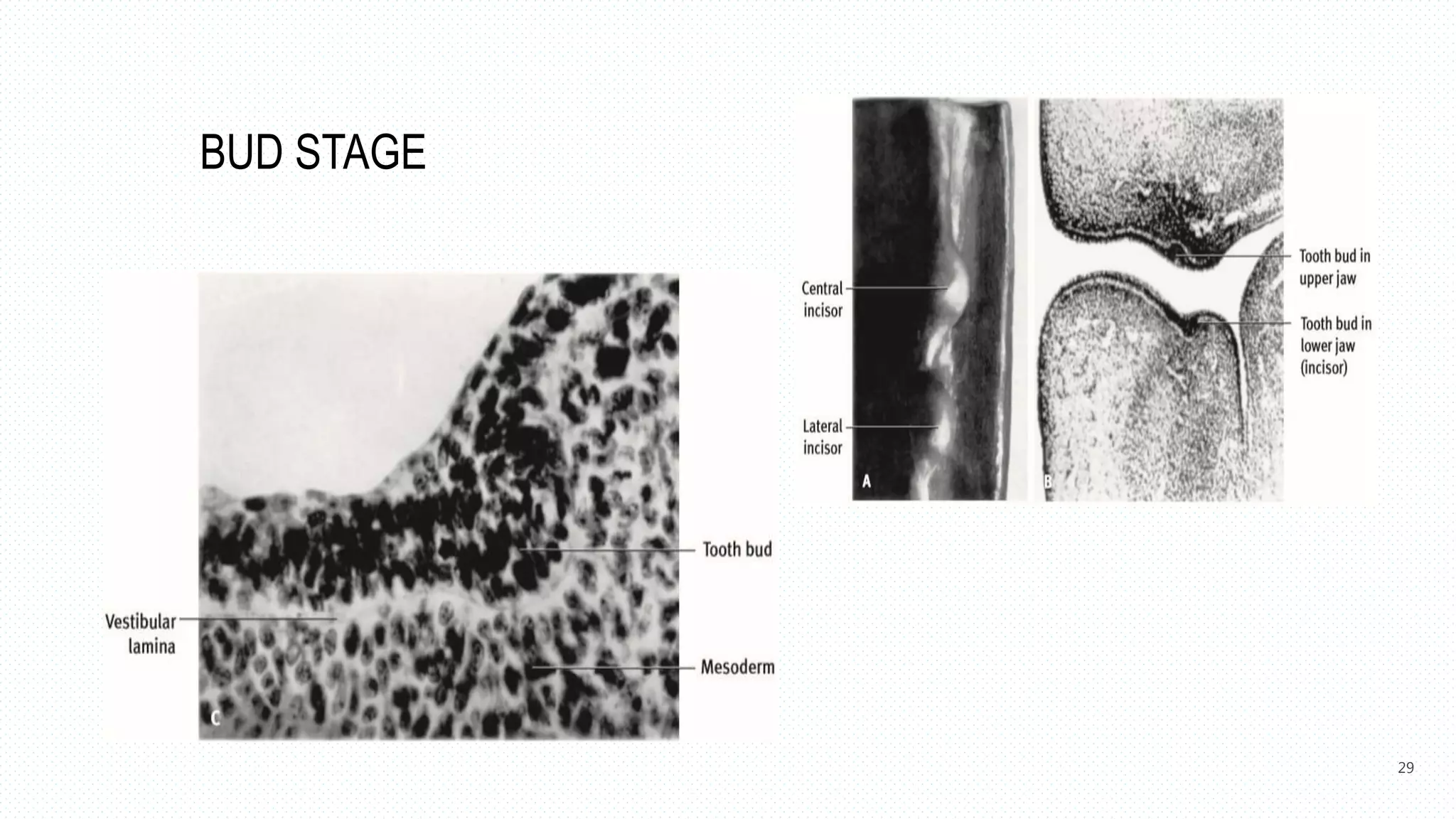 Tooth development and its abnormalities | PPTX
