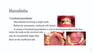 Tooth development and its abnormalities | PPT