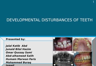 Tooth development disturbances 1.pdf.ppt | Free Download