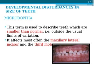 Tooth development disturbances 1.pdf.ppt | Free Download