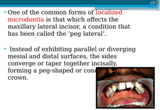 Tooth development disturbances 1.pdf.ppt