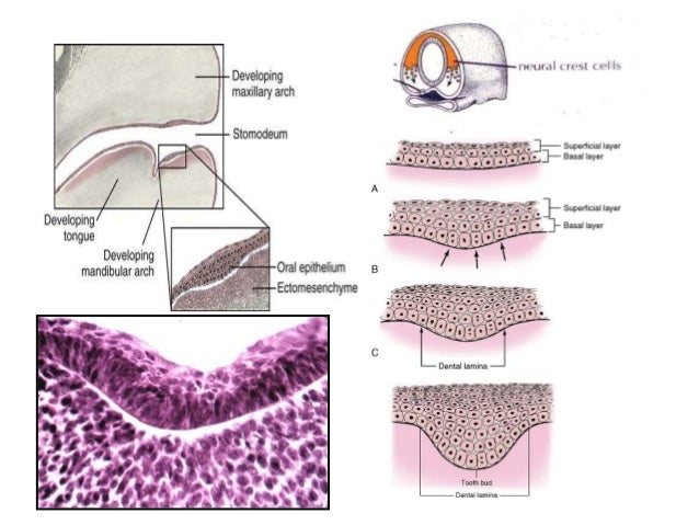Tooth development