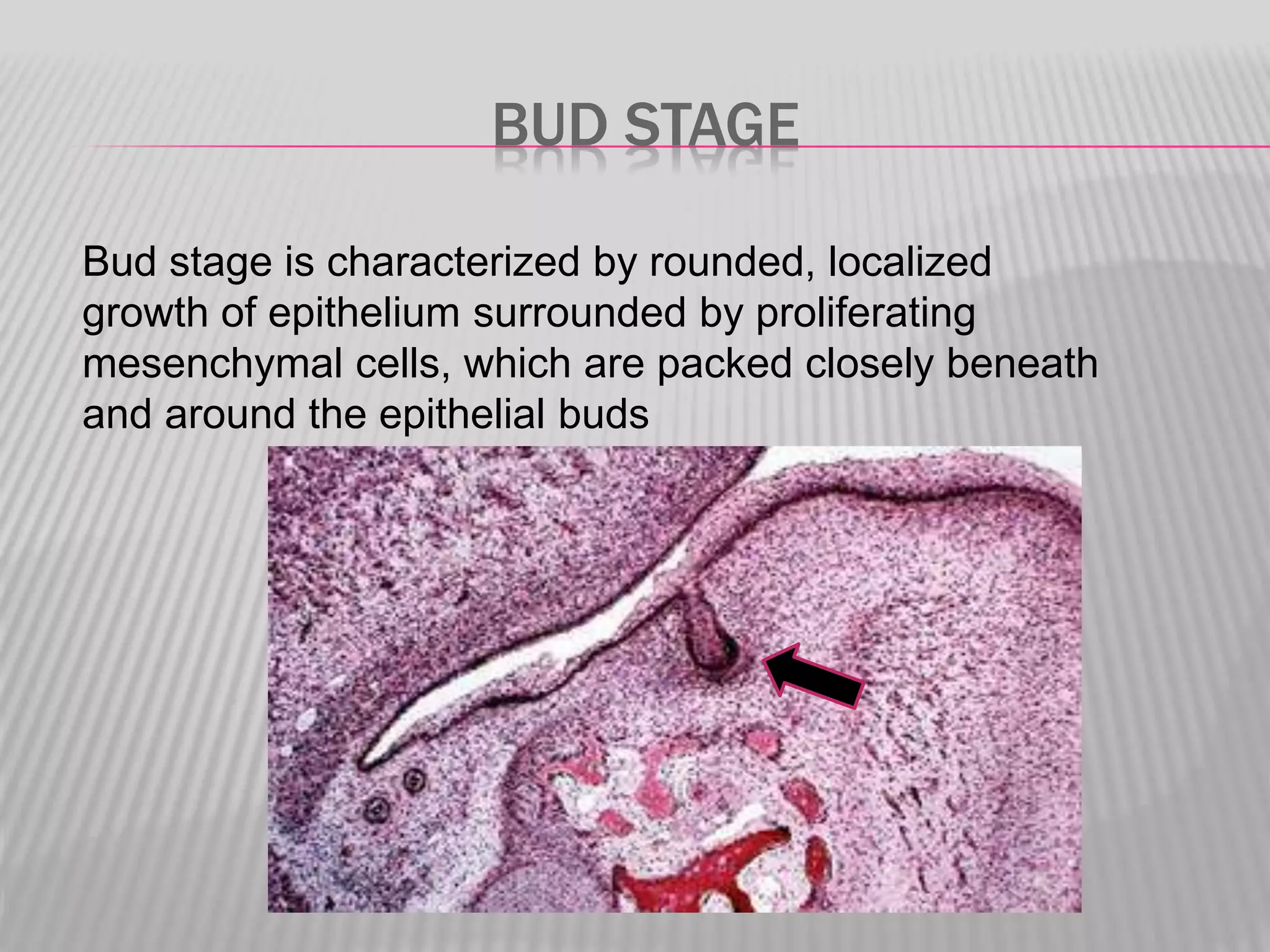 Tooth Development & Molecular aspect | PPTX | Dental Health | Diseases ...