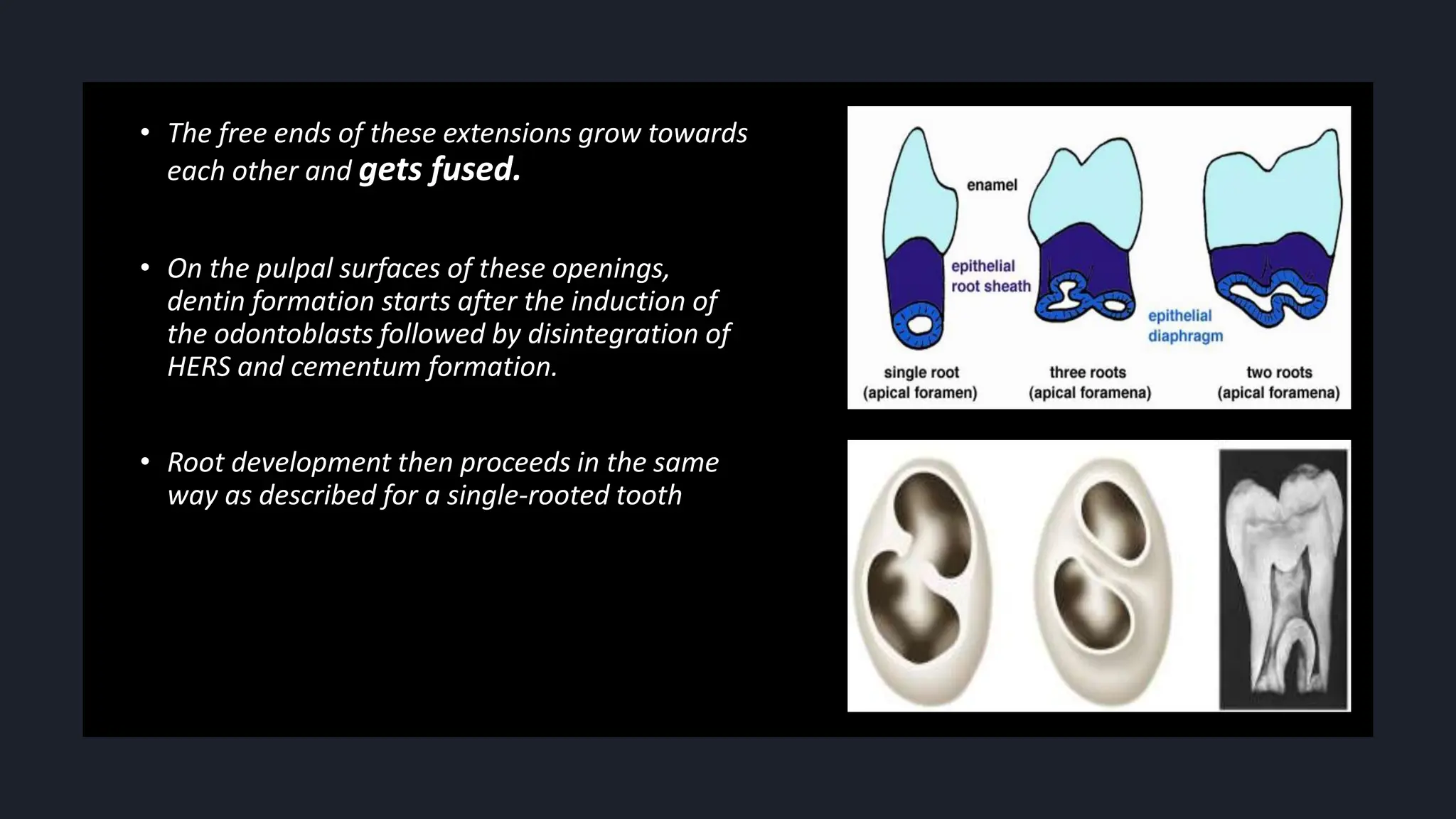 Tooth development along with clinical importance - Oral histology | PPTX
