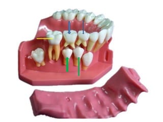 Tooth development -2 | PPT
