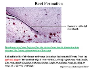 Tooth development -2 | PPT