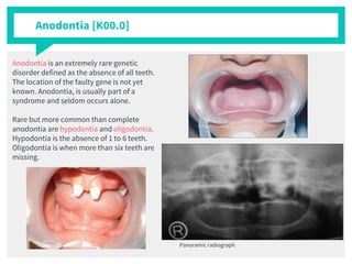 Tooth Pathology Powerpoint | PPT