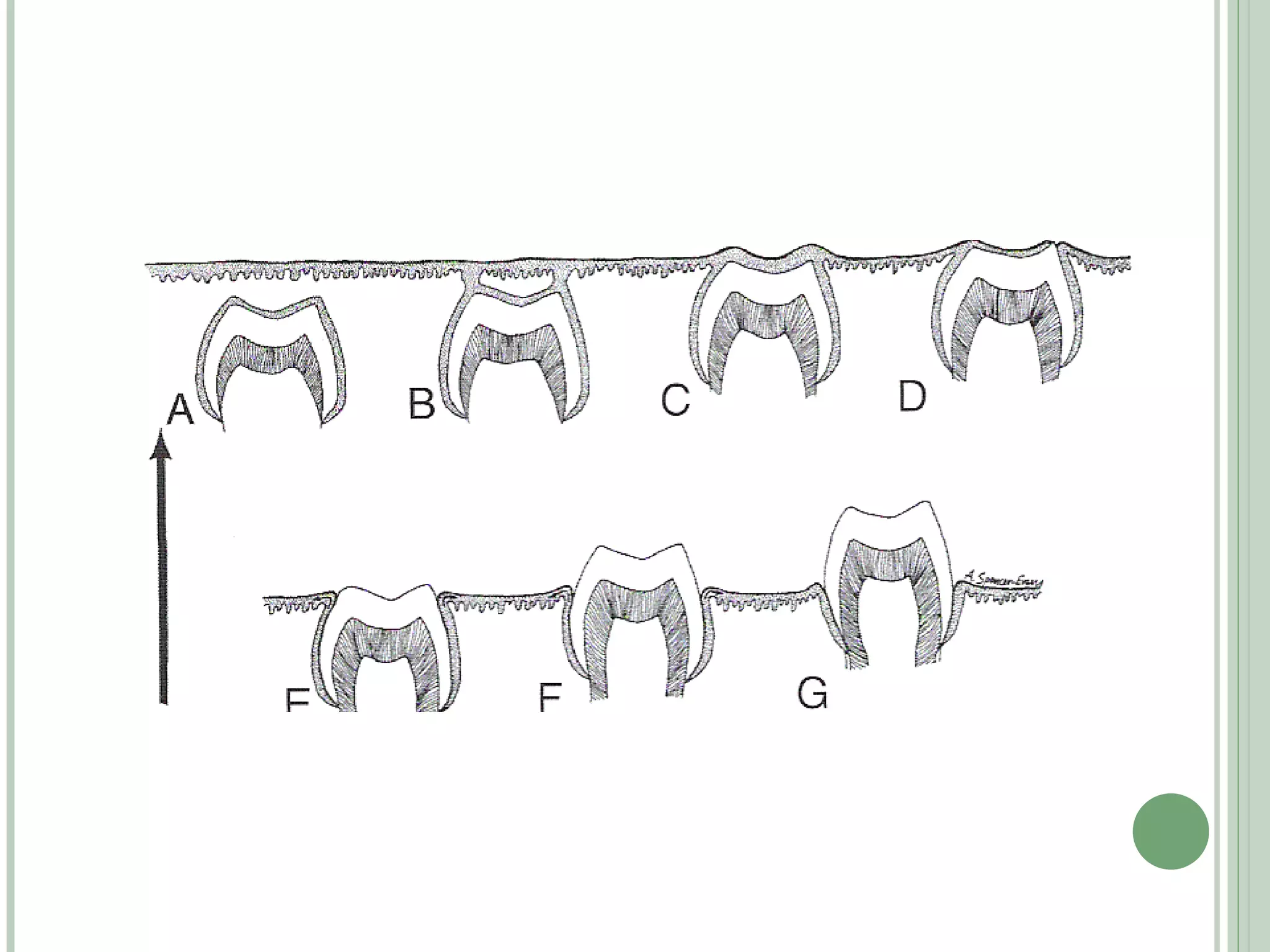 Tooth eruption | PPT